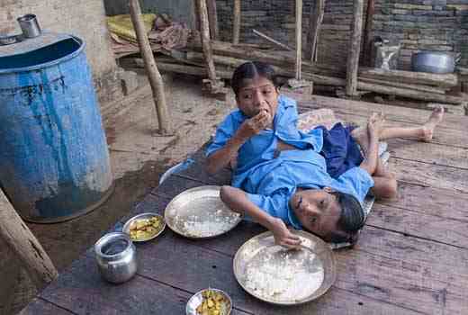 The Indian conjoined twins who are worshipped as a divine incarnation