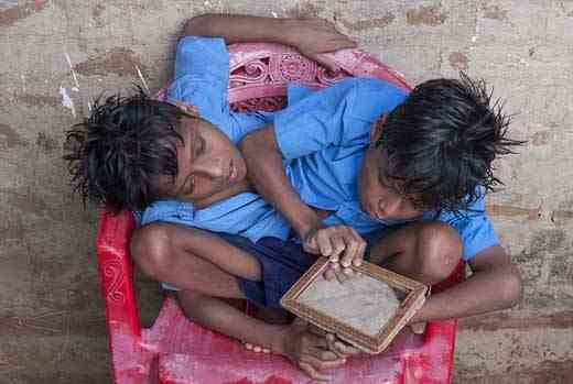 The Indian conjoined twins who are worshipped as a divine incarnation